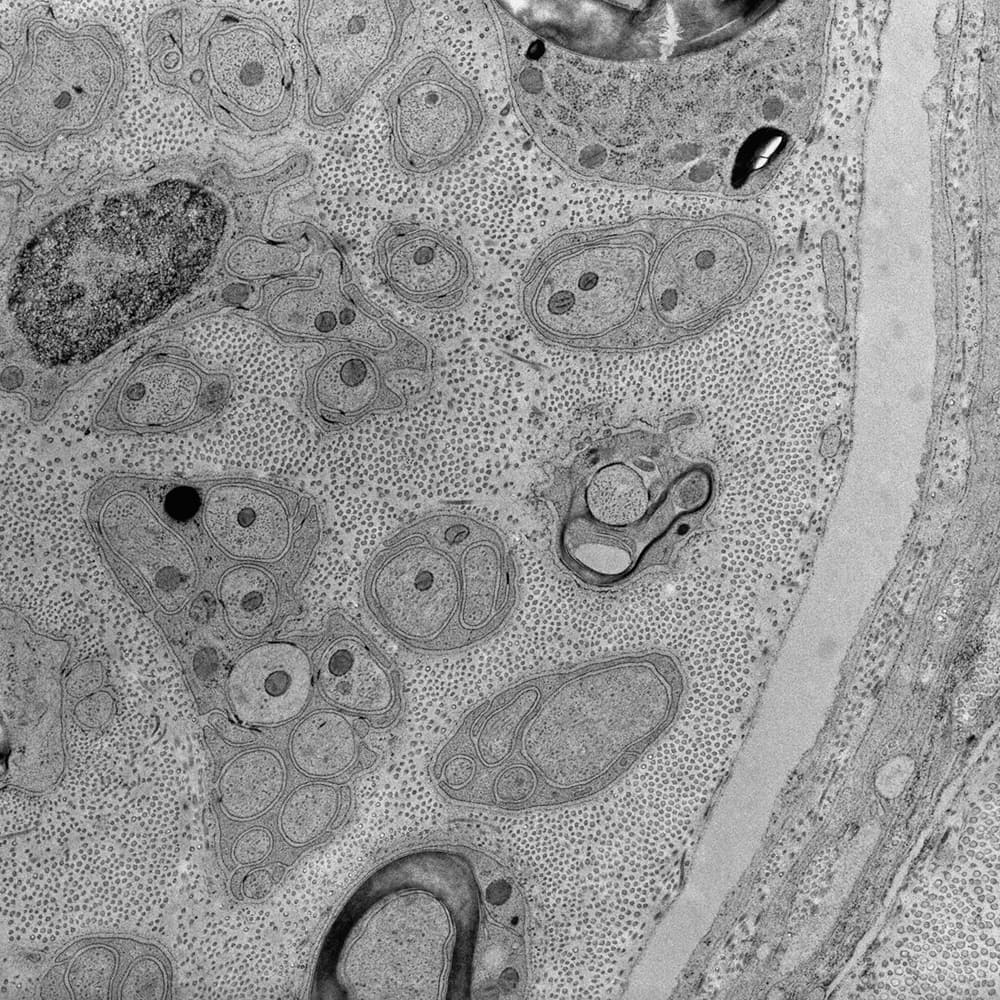 ultra 45° Jumbo | DiATOME