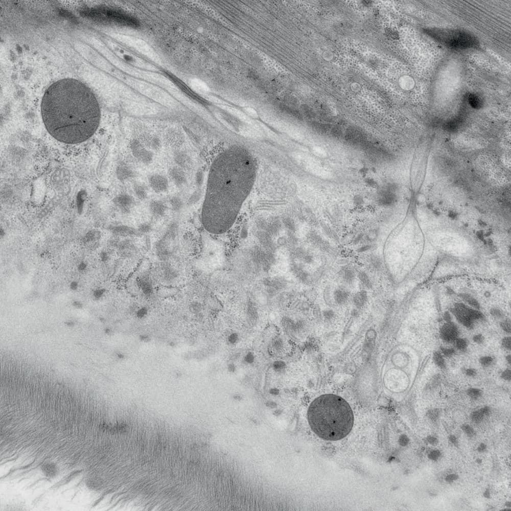 ultra 45° | DiATOME